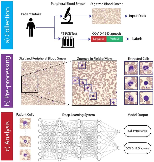 Workflow of automated COVID-19 infection analysis from peripheral blood smear (PBS) image data