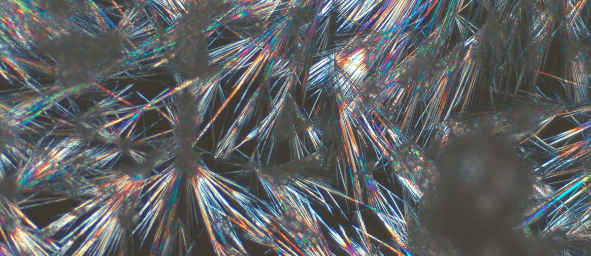 Research at the intersection of biomedical optics,